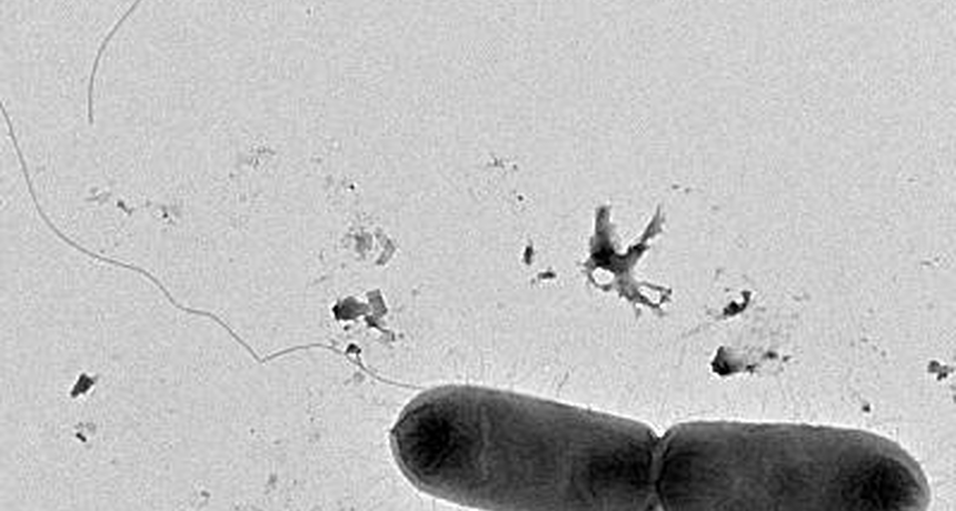 Salmonella Under the Microscope, The Infectious Diseases Research Lab ...